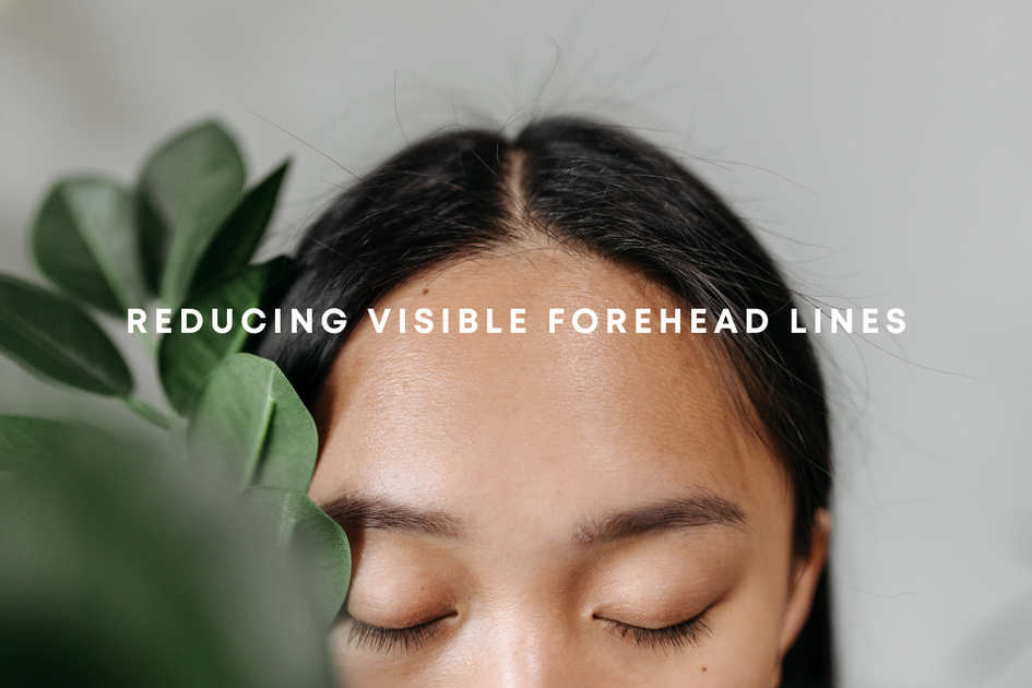 How to reduce appearance of forehead lines – Sigi Skin